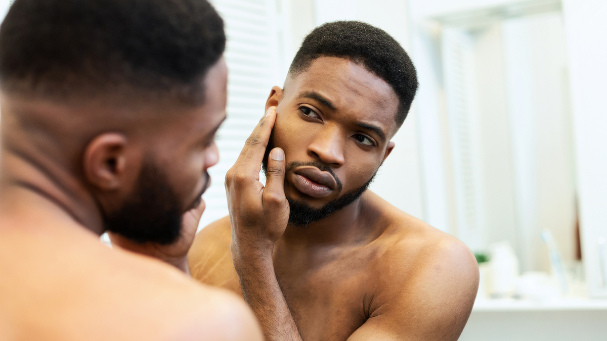 Do SARMs Cause Acne? [What You Need To Know!]
